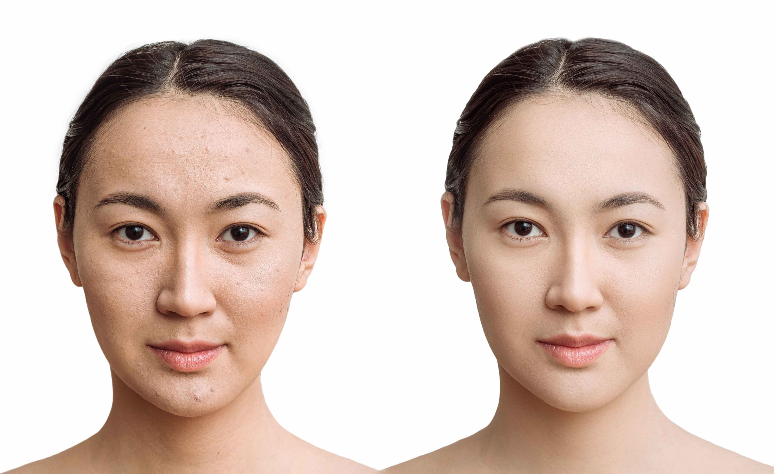 Can Skincare Shift Away From Promising Immediate Results? | Beauty ...